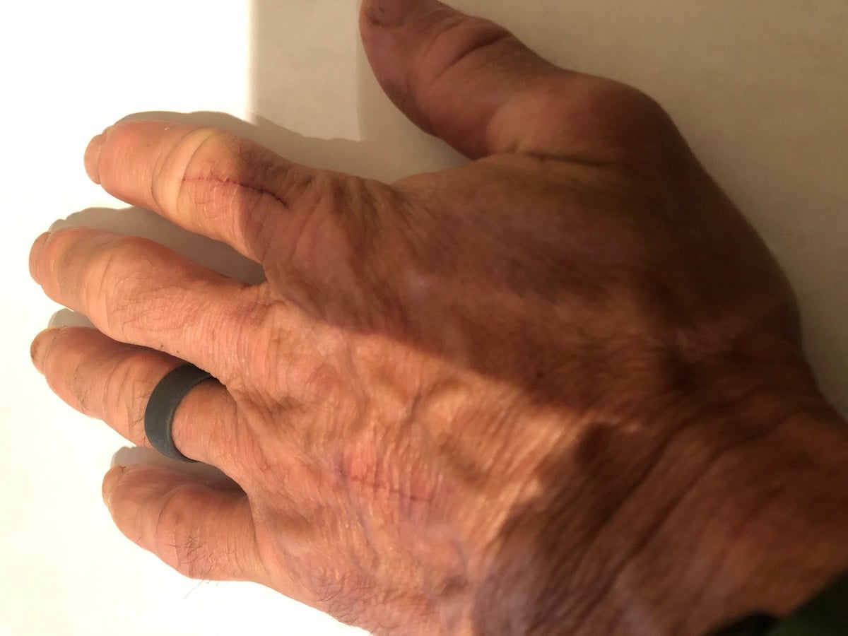 Simple, well-built silicone rings that are worth a look for climbers ...