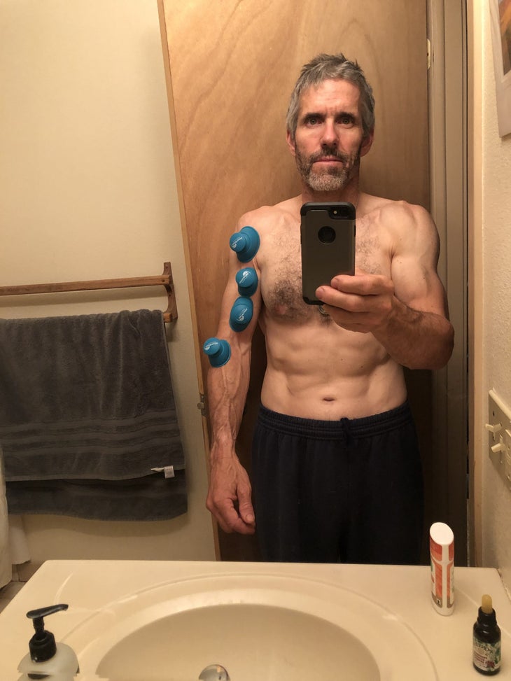 First Look: Wave Tools Therapy Riptide Sport Cupping Set