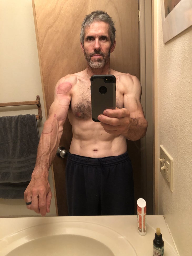 First Look: Wave Tools Therapy Riptide Sport Cupping Set